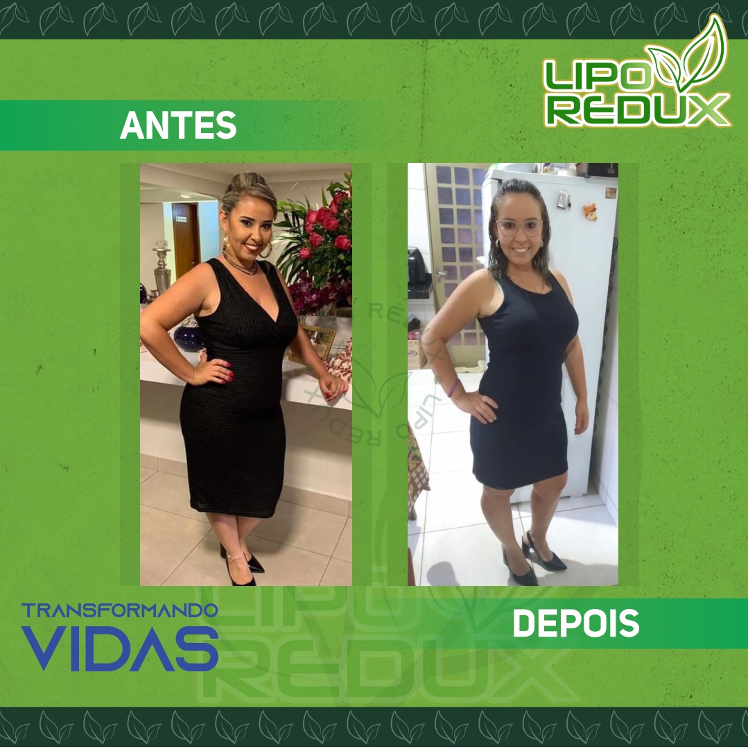 LipoRedux Oficial, Loja Online | Shopee Brasil