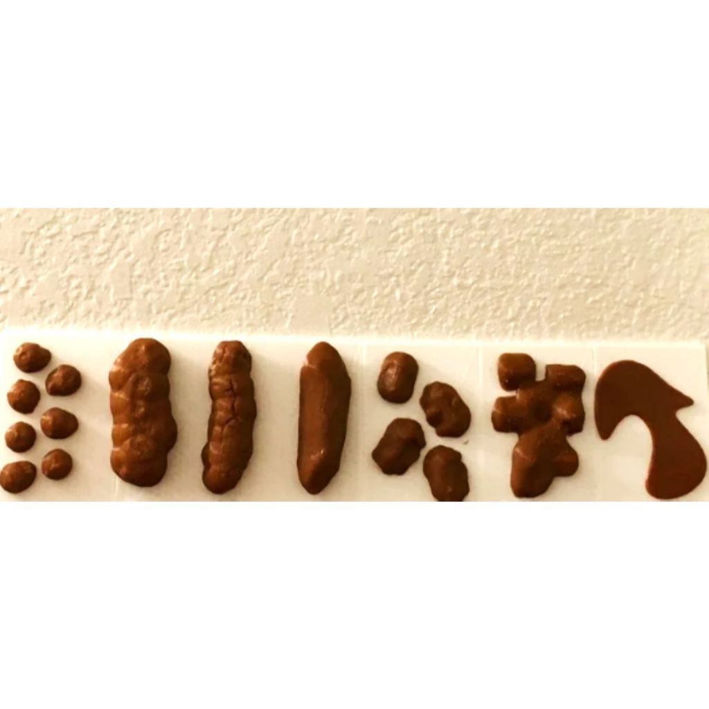 Escala de Bristol 3D