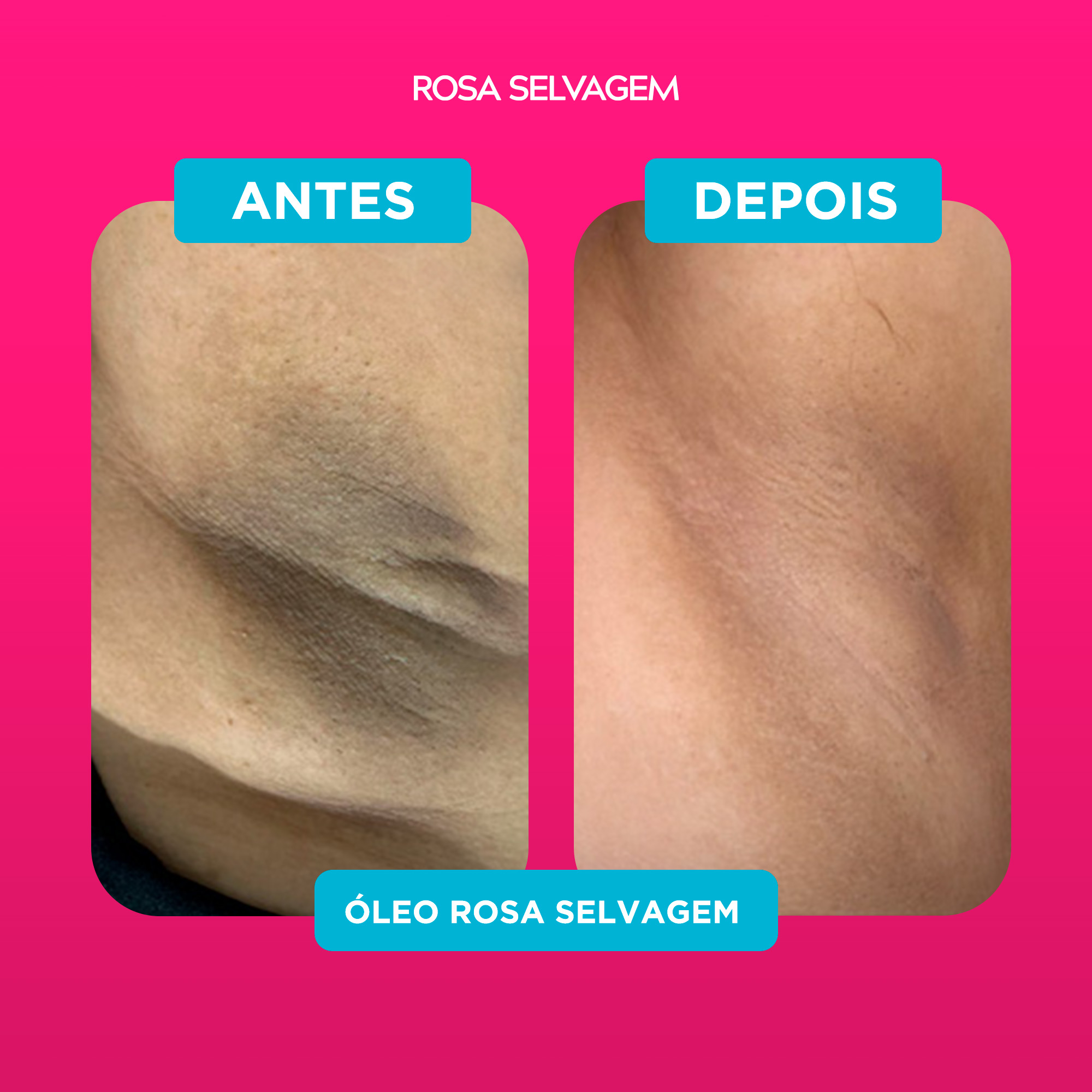 Rosa Selvagem Loja Oficial, Loja Online | Shopee Brasil