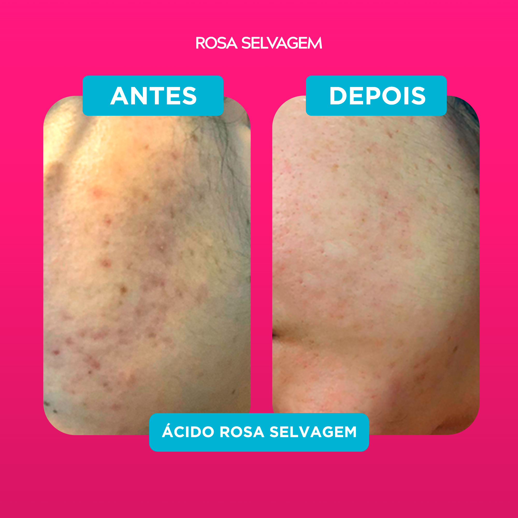 Rosa Selvagem Loja Oficial, Loja Online | Shopee Brasil